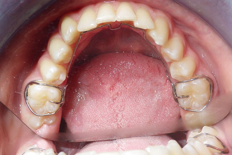 SmileLase (Laser Therapy) - Center for Wellness